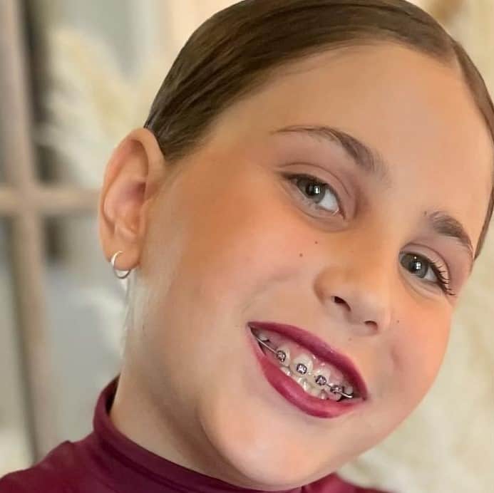 Empower® Self-Ligating Braces Treatment in Calgary | Sierra Dental