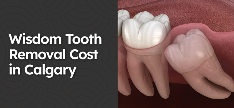 Wisdom Tooth Removal Cost in Calgary | Sierra Dental